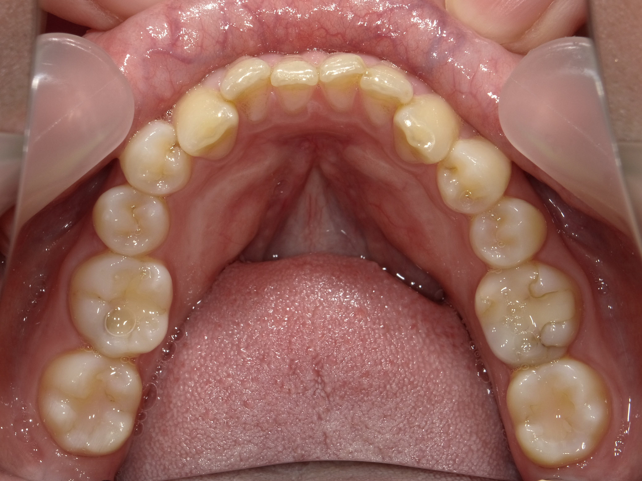 SHOFU DENTAL DIGITAL CAMERA | 三越前駅小伝馬町歯科 ハルデンタルオフィス
